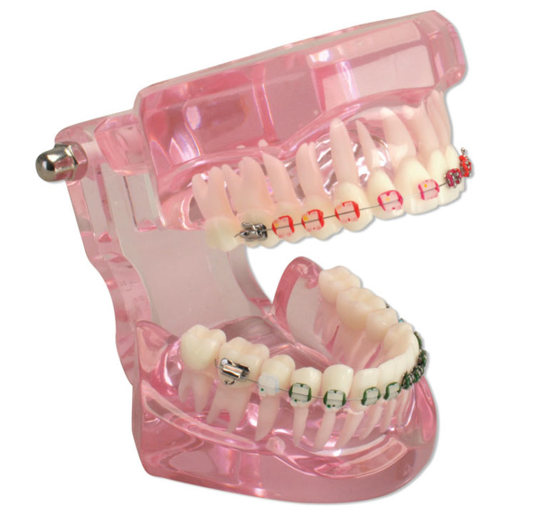 Study Model ORTHO-Brackets – Hager & Werken